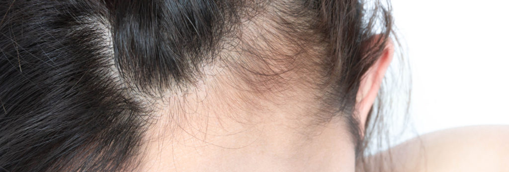 Hairline Microblading – Infinique Skin & Spa